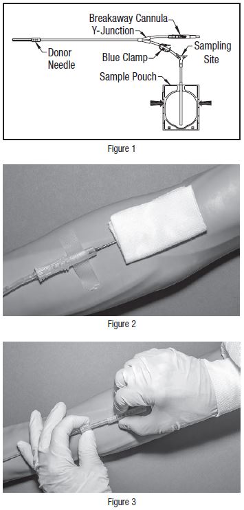 Anticoagulant Citrate Phosphate Dextrose (CPD) Solution and ADSOL ...
